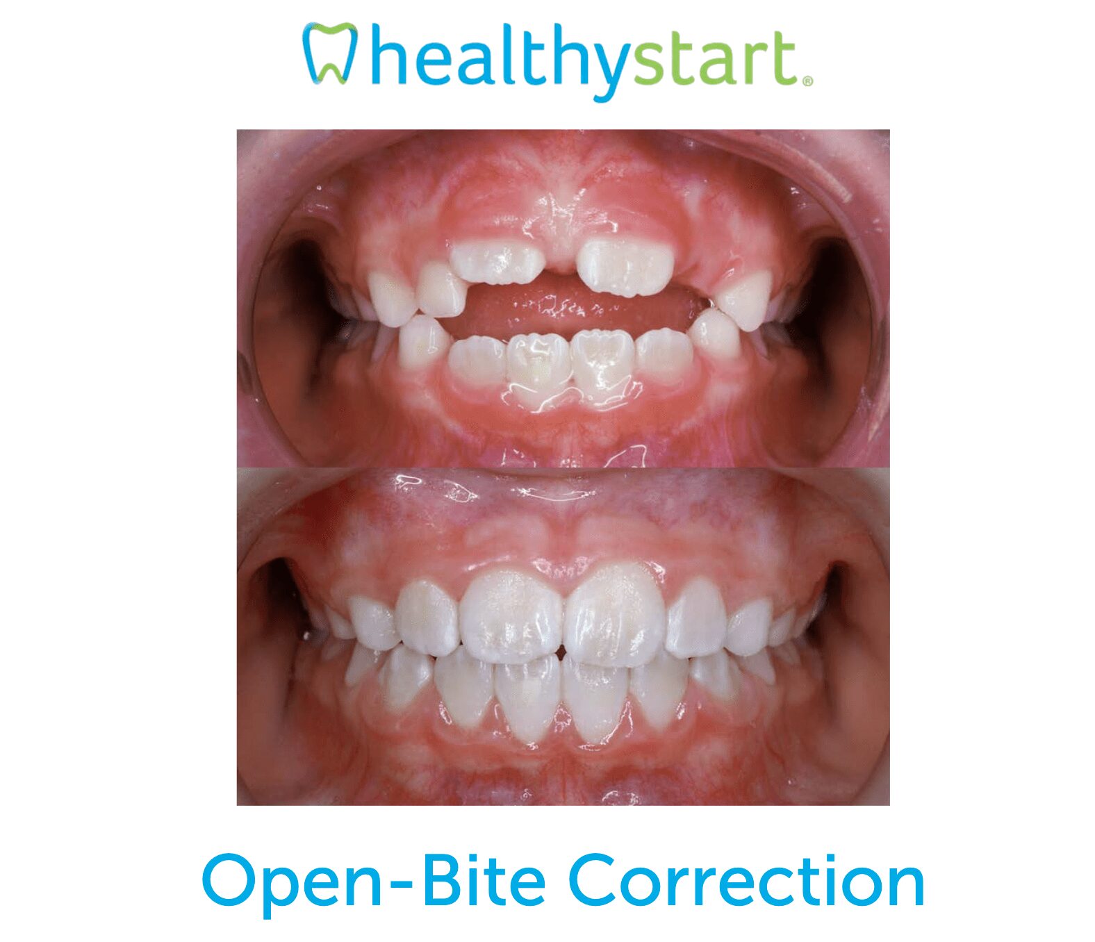 Healthy Start Program For Kids - River Family Dentistry